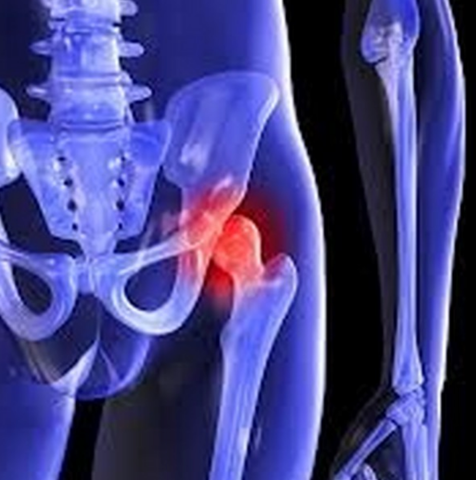 Trigger Point Therapy - Bilateral Groin Pain | Groin, Hips and more | Niel Asher Education Blogs ...