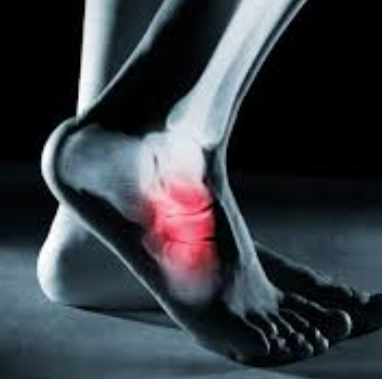 Trigger Point Therapy - Leg and Foot Injuries | Achilles Tendinitis ...