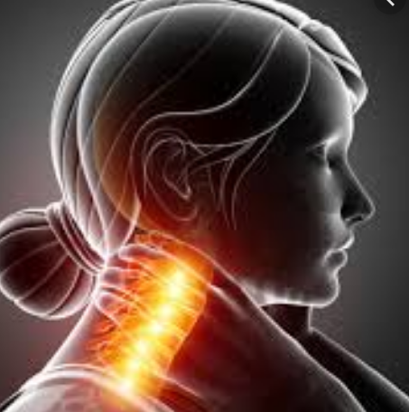 Key Trigger Points for Neck Discs and Nerve Pain (Radiculopathy) | Neck ...